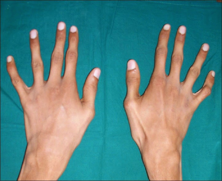 Study Medical Photos A 32 Year Old Male Presents In ER With Sharp study-medical-photos-a-32-year-old-male-presents-in-er-with-sharp