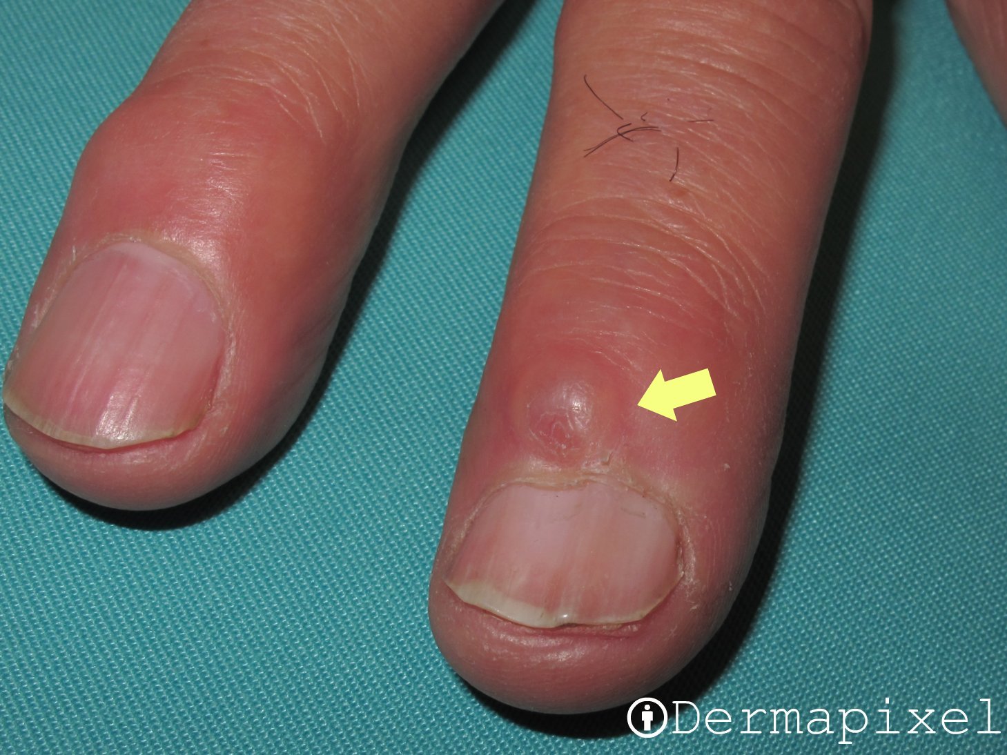 Dermapixel: marzo 2012