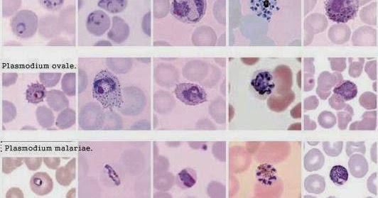 Medical Laboratory and Biomedical Science: Malaria Training Materials