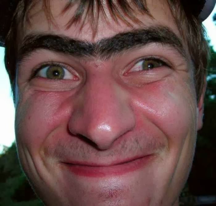 BeautyIsInTheEyesOfMe Waardenburg Syndrome beautyisintheeyesofme-waardenburg-syndrome