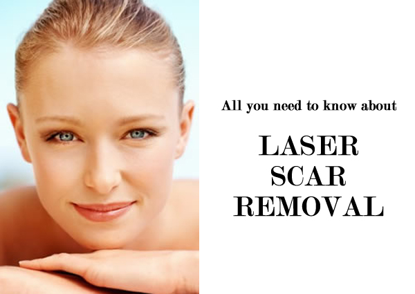 Carinn; carerynn | Malaysia Fashion, Beauty & Lifestyle Blog: [Guest Post] All You Need To Know ...