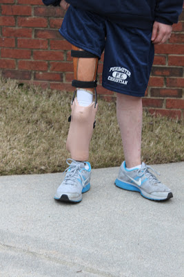 Leaving It All On The Field: Rotationplasty Prosthetic Leg...The Final ...