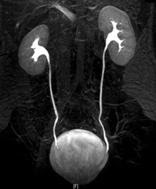 URO RM: URORESONANCIA