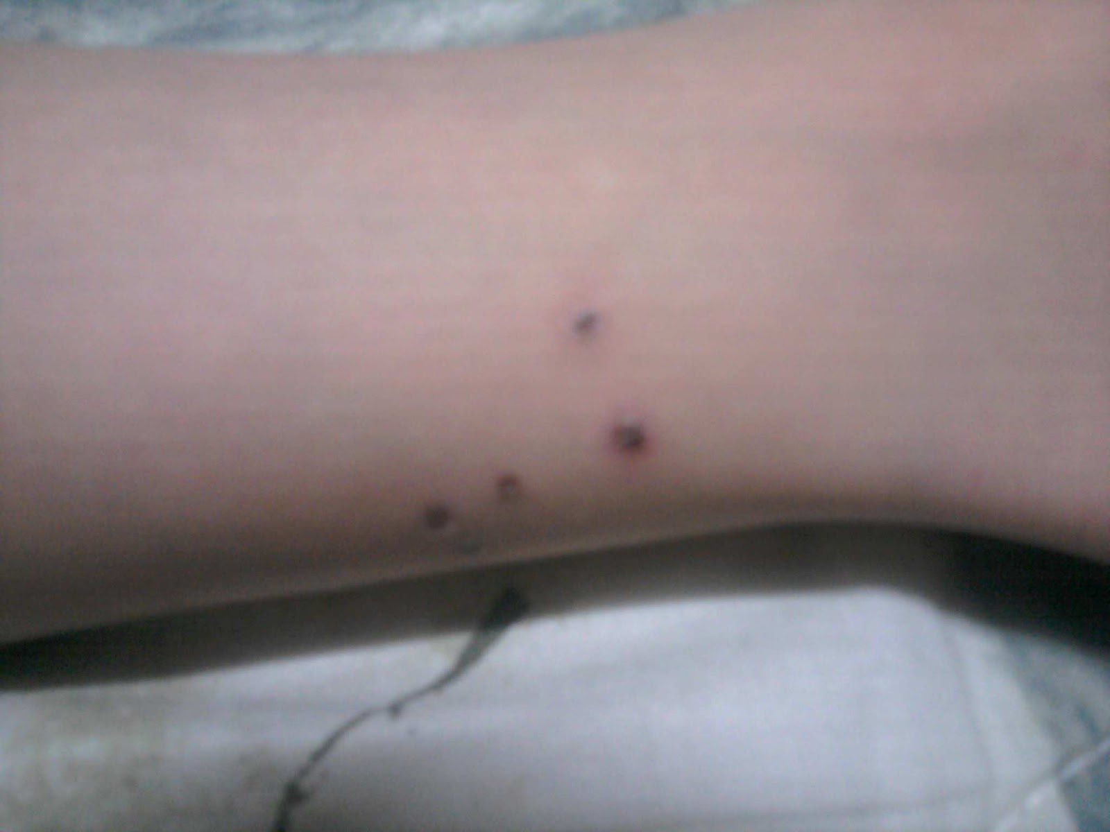 Diary Returning Home Chicken Pox And The Kids diary-returning-home-chicken-pox-and-the-kids