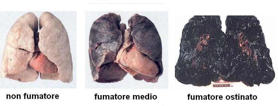 31 de Mayo se celebra el Día Mundial sin Tabaco | El espacio del profe ... 31 de Mayo se celebra el Día Mundial sin Tabaco | El espacio del profe ...
