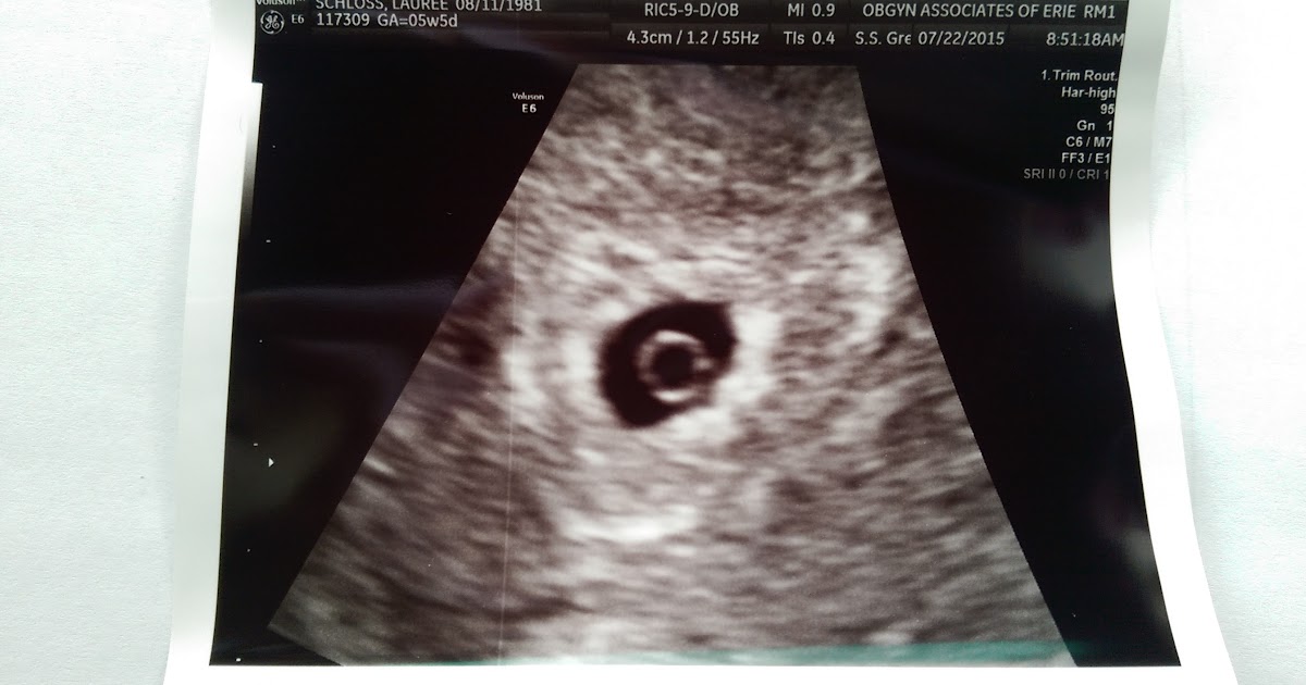 Just Relax and It Will Happen: 5w5d - Ultrasound!! & Beta #5!!!!!