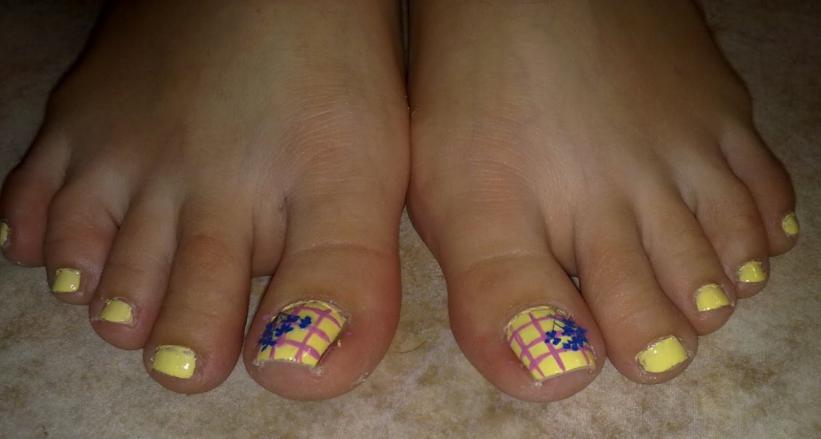 What To Do When You Break Your Toe Nail Kondvek what-to-do-when-you-break-your-toe-nail-kondvek