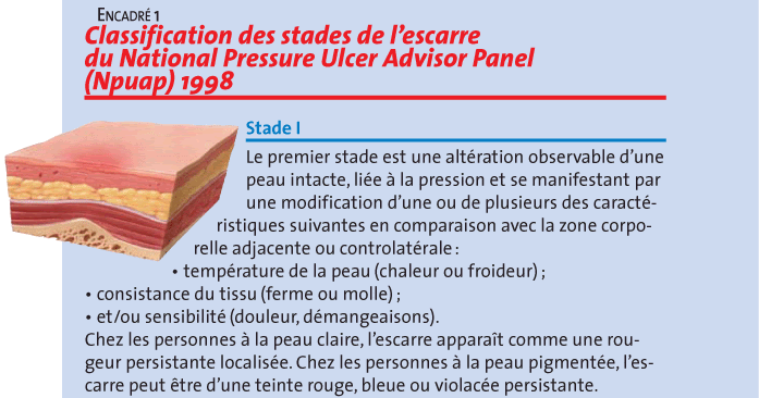 Aide Soignant (e): Classification des stades de l'escarre