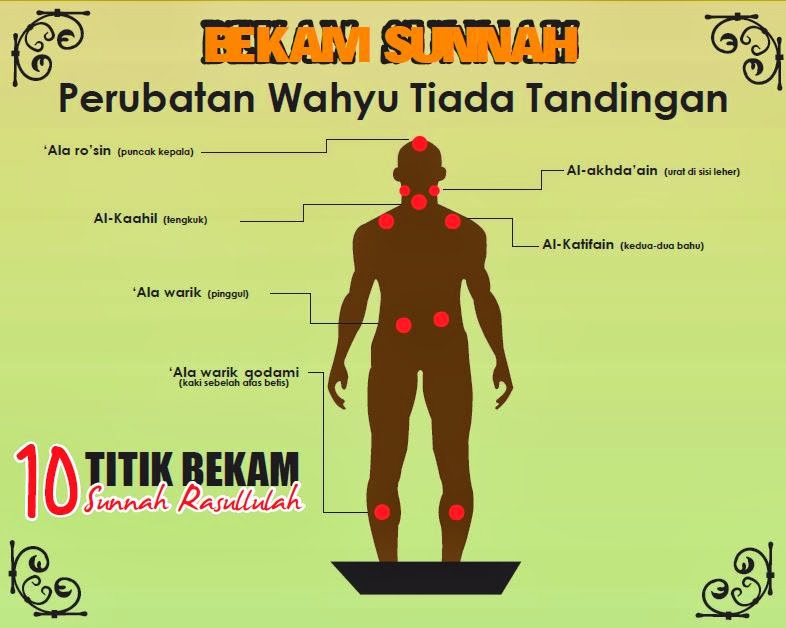 10 TITIK SUNNAH