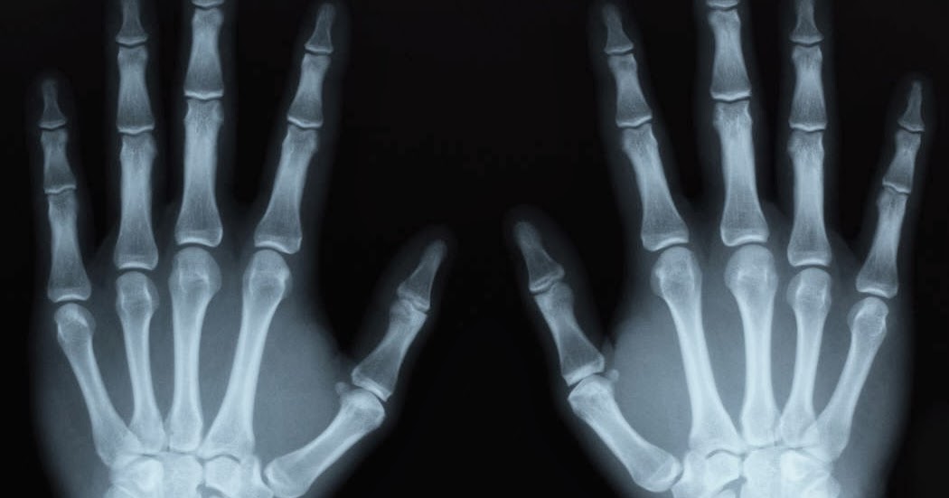 The Big Light In The Sky How Do You Use X rays the-big-light-in-the-sky-how-do-you-use-x-rays
