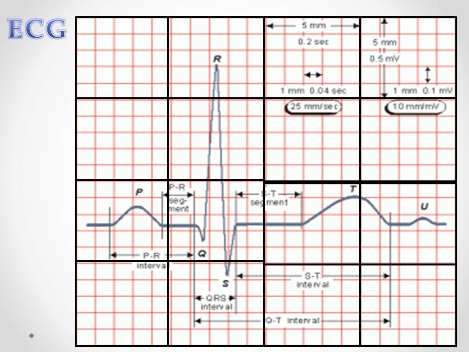 Fisiología Básica: Electrocardiograma Normal