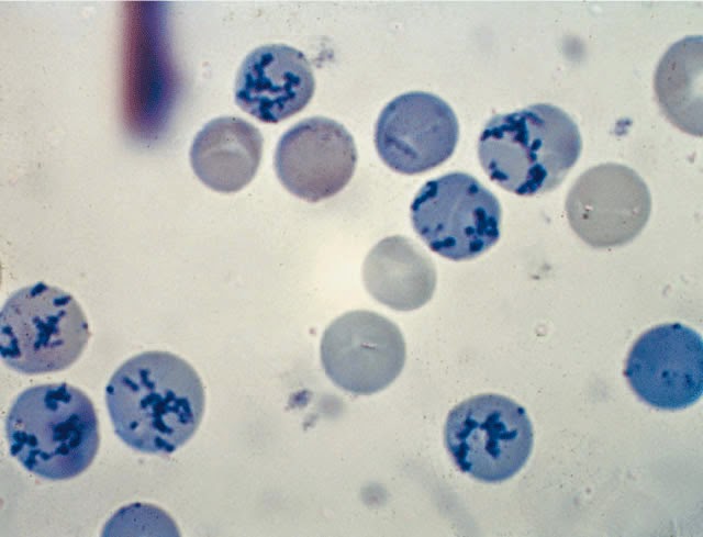 Fichero de Hematología Heber Mayén: Reticulocito