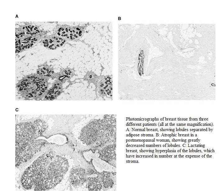 MBBS Medicine (Humanity First): Neoplasia : Differentiation and anaplasia MBBS Medicine (Humanity First): Neoplasia : Differentiation and anaplasia