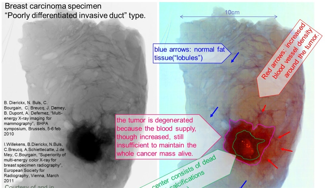 Medicine and Technology: Future Color X-ray technology illustrated Medicine and Technology: Future Color X-ray technology illustrated