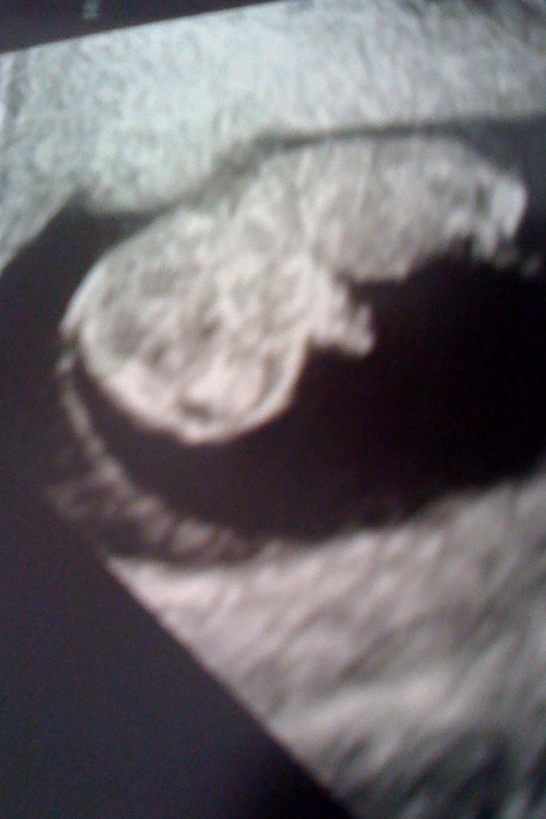 Pregnancy Blog First Ultrasound pregnancy-blog-first-ultrasound
