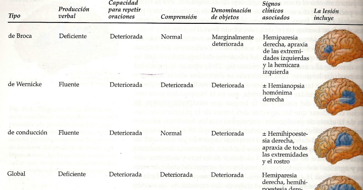 Trastornos del lenguaje oral: Clasificación de los tipos de afasias