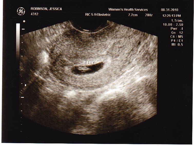 Baby MARJAR First Trimester baby-marjar-first-trimester