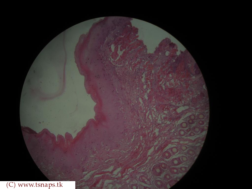 Histology Slides Database: human LIP histology slides Histology Slides Database: human LIP histology slides