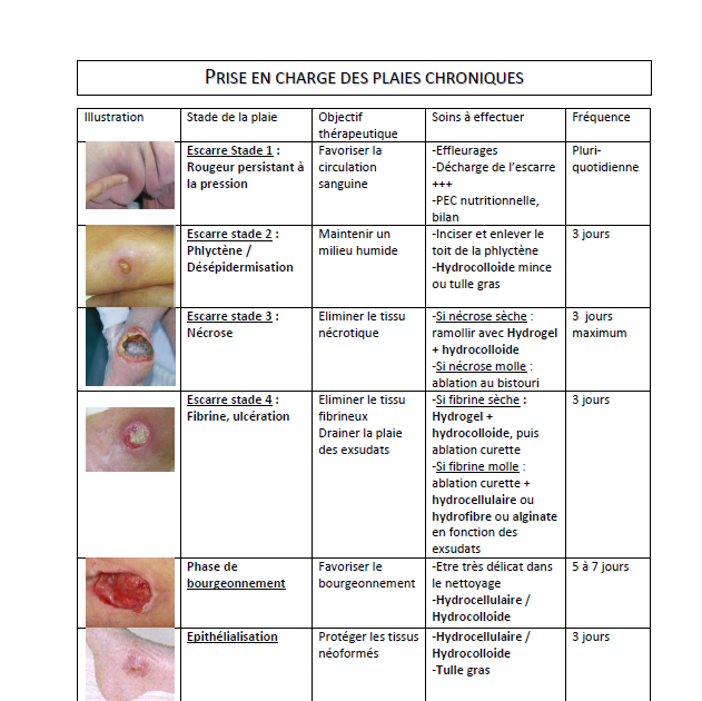 AnneSof étale sa science: Un tableau pour s'y retrouver dans le traitement des escarres
