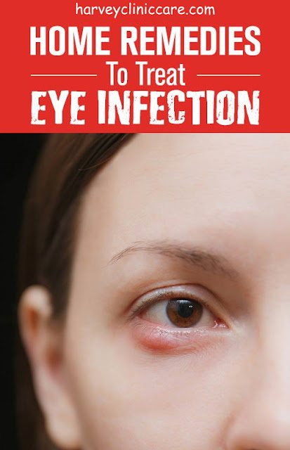 How To Cure An Eye Infection In Just 24 Hours With This Home Remedy ...