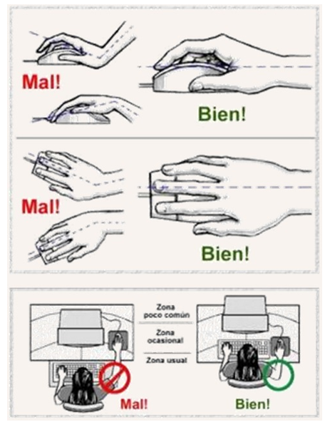 Síndrome del ratón