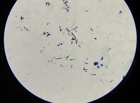 LAPORAN PRAKTIKUM MIKROBIOLOGI ALT: UJI CEMARAN MIKROBA METODE ANGKA ...