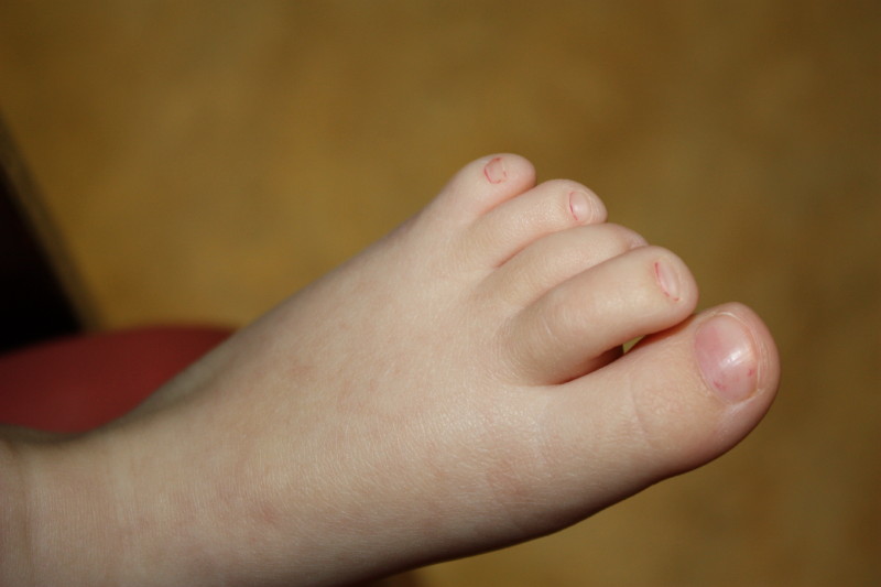 The Rosek Family: Surgery #5