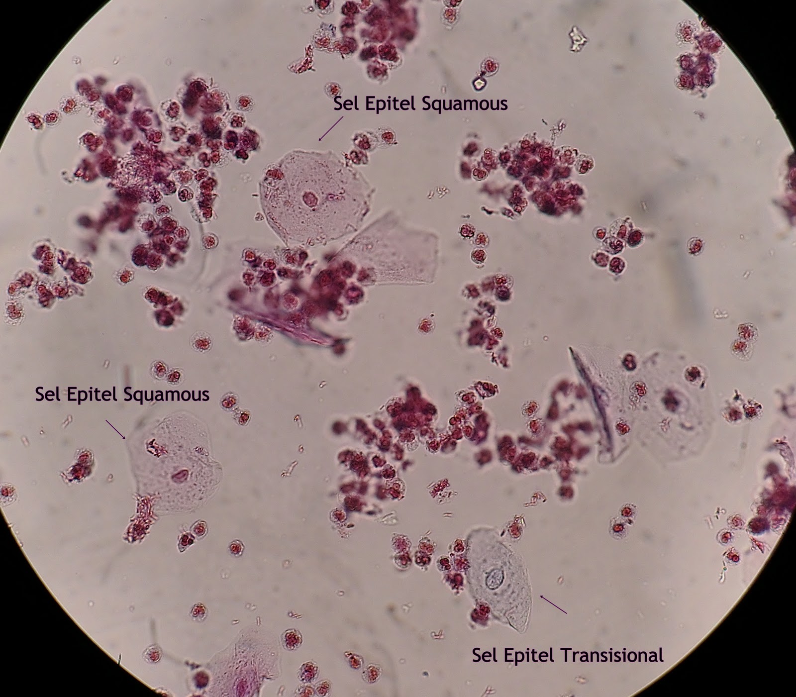 Cara Pemeriksaan Sedimen Urine Metode Terbaru | Noey Lab|Tips Kesehatan ...