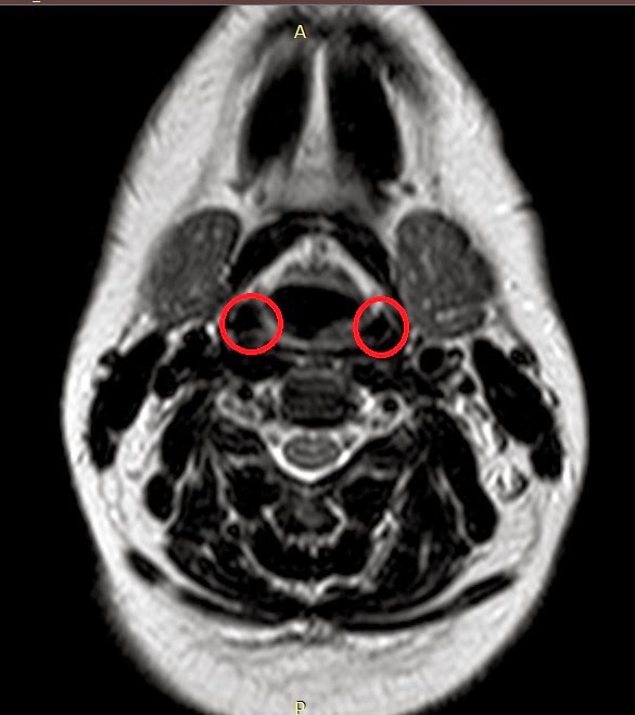 ESPE 202 - 2014: Anatomía y patología de cuello