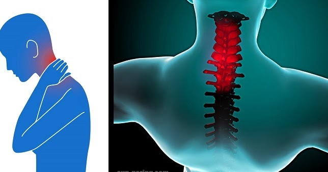 How To Get Rid Of A Stiff Neck Naturally, In Just 90 Seconds