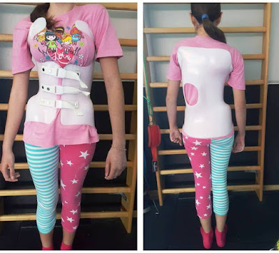 Despre corsetul Cheneau :: Corset scolioza / scoliosis braces