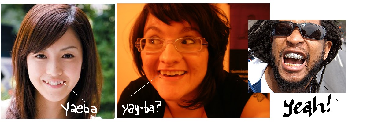 Yaeba Teeth Before And After