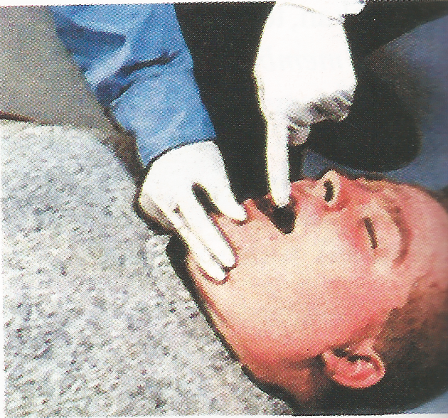 Bantuan Hidup Dasar & Resusitasi Jantung Paru (RJP) - Manajemen K3 Umum