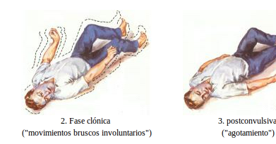 Gestión de Riesgos - Capilla del Monte: ¿Qué hacer ante convulsiones?
