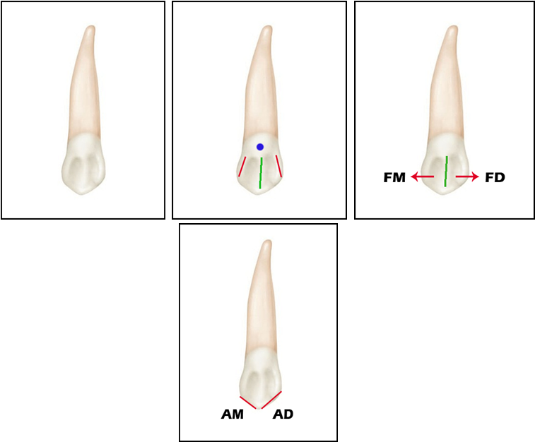 Aula de Anatomia Dental - Canino Superior - Dente 13 e 23