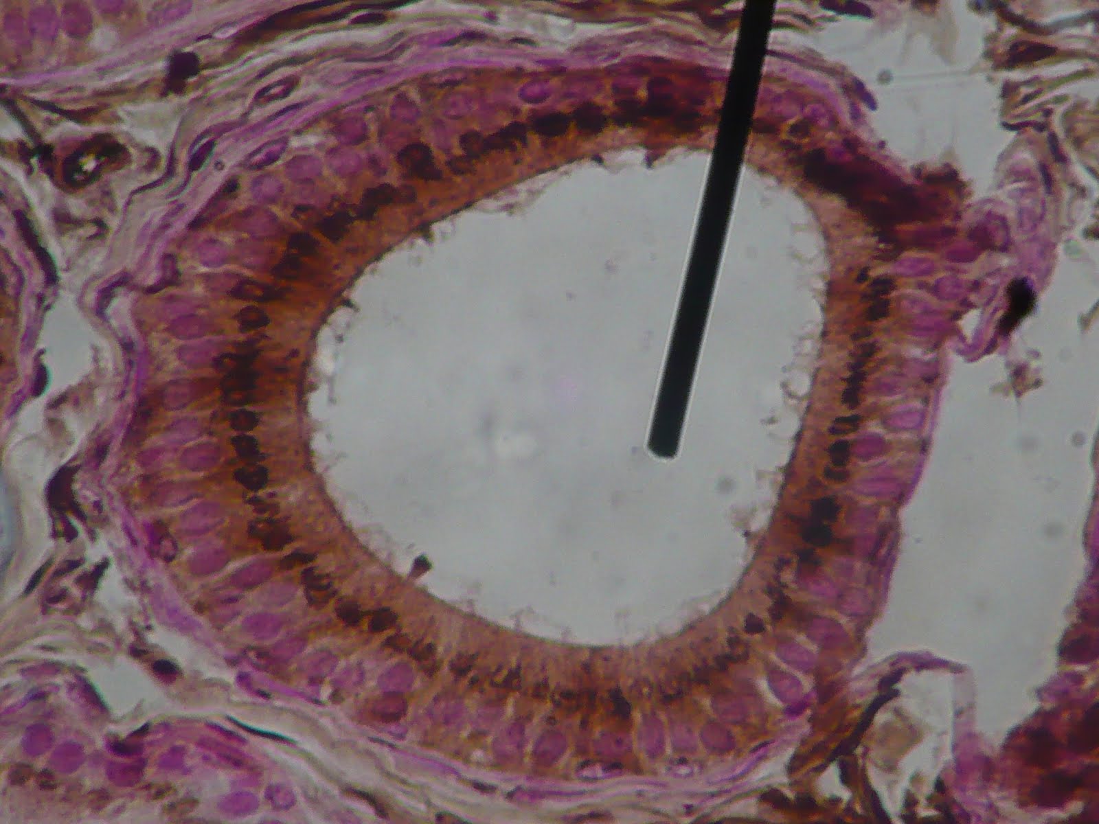 MEDICINA USMP: APARATO DE GOLGI en Epididimo