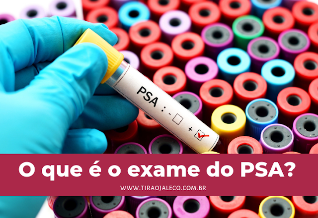 PSA - Para que serve esse exame? - Tira o Jaleco