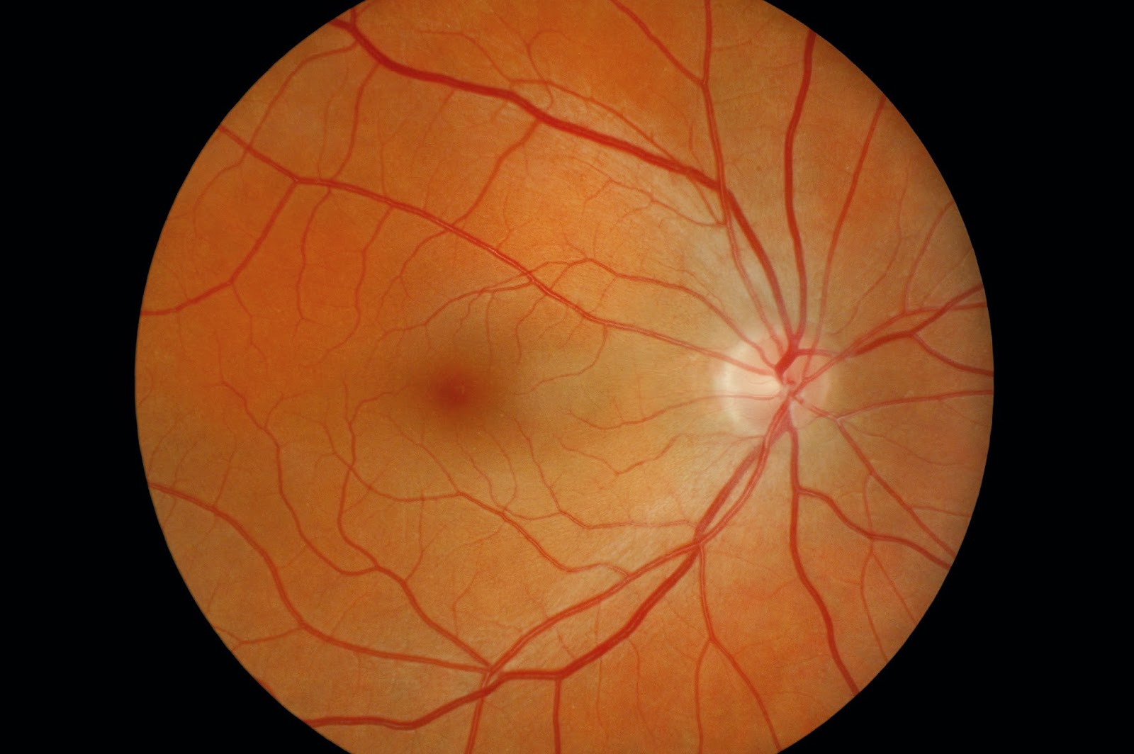 content write ups: Abnormal