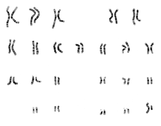 Karyotyping- Definition, Principle, Preparation and Technical Procedure ...