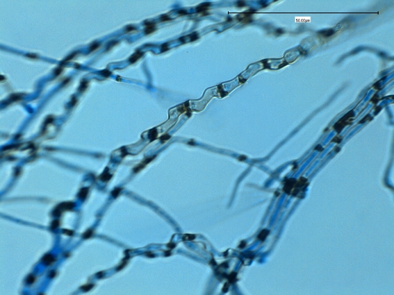 Fun With Microbiology (What's Buggin' You?): Fonsecaea pedrosoi/monophora