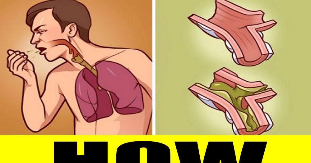 Get Rid of Phlegm and Mucus in Chest & Throat with These Home Remedies ... Get Rid of Phlegm and Mucus in Chest & Throat with These Home Remedies ...