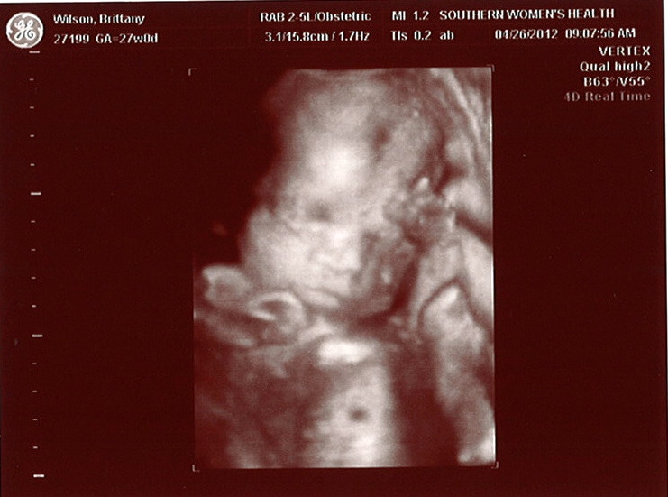 At Home with the Wilsons: Baby has a name