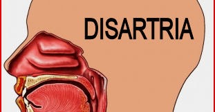 Fonoaudiologia e Concursos: DISARTRIA