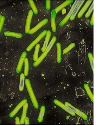 Informasi Kesehatan dan Kedokteran: Definisi dan Etiologi Penyakit Tetanus