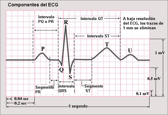 Evidencias de fisiología de Iris : Descripción de un ECG