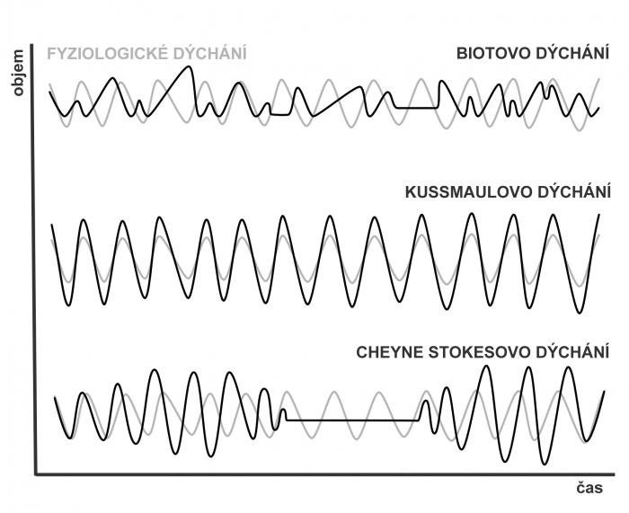 ParaKocour: Záchranářská abeceda - B