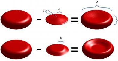 Using math and light to detect misshapen red blood cells ~ Health ...