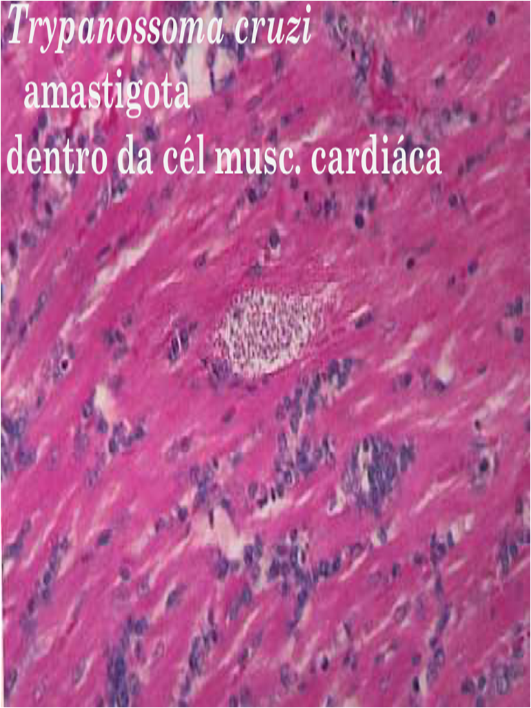 Trypanosoma cruzi - Parasitologia