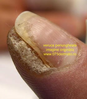 DERMATOLOGIA APROAPE DE TINE CABINET DERMATOLOGIE IASI DERMATOLOG ...