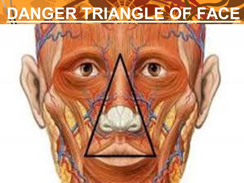 المدونة الطبية د.فهيد سالم السبيعي: DANGER TRIANGLE OF THE FACE DR ...